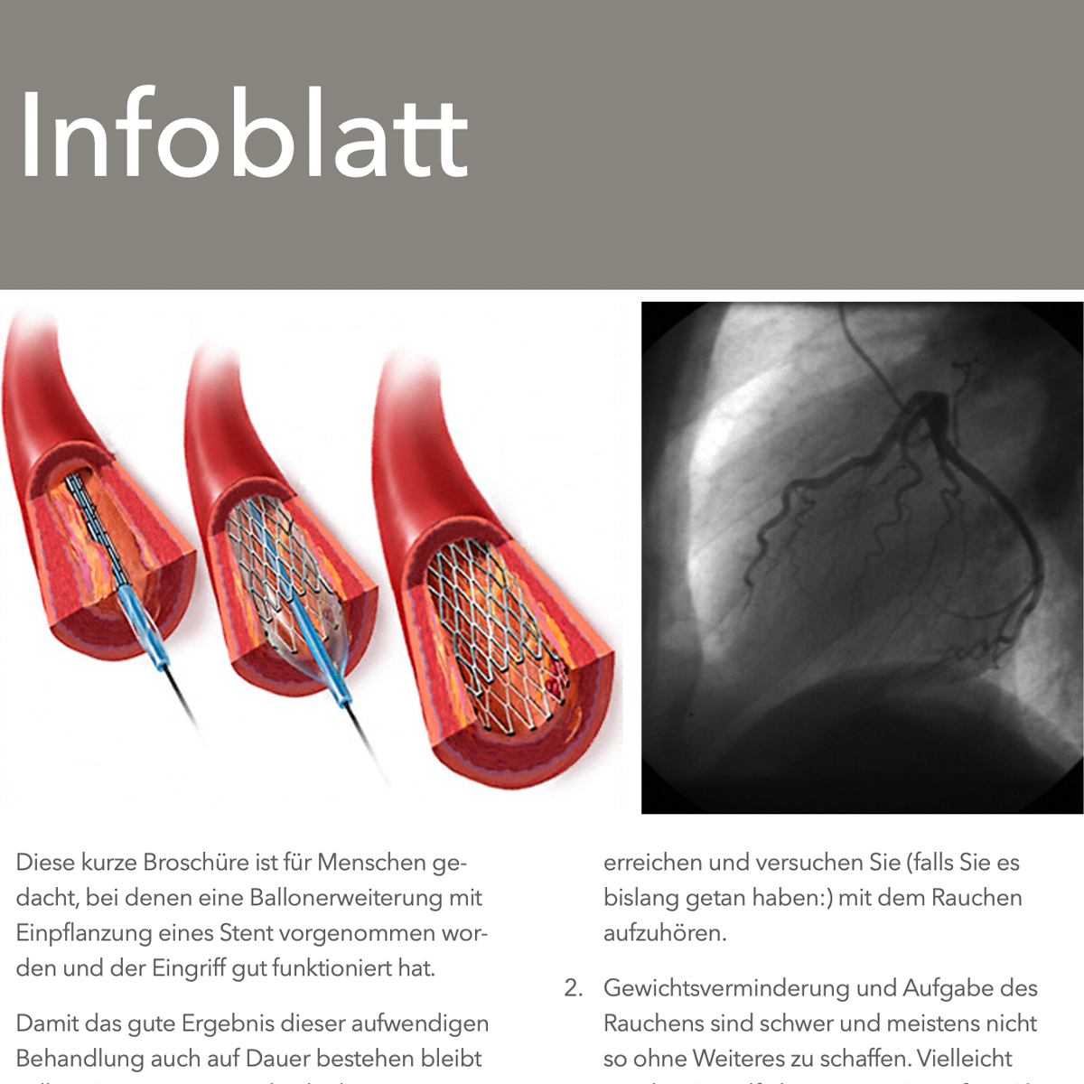 PTCA und Stent