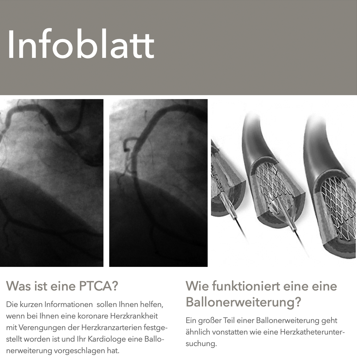 PTCA und Stent